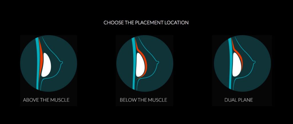 What Is an Infographic & Why Should You Use Them? | Rosemont Media